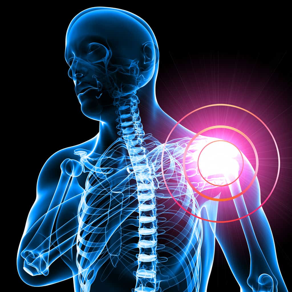 Current Concepts in the Treatment and Recognition of SLAP Tears ...